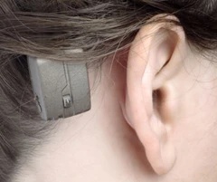 Are Bone-Anchored Hearing Aids Safe for Kids?-(helped 92 people ...